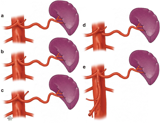 Normal and Variant Mesenteric Anatomy | SpringerLink