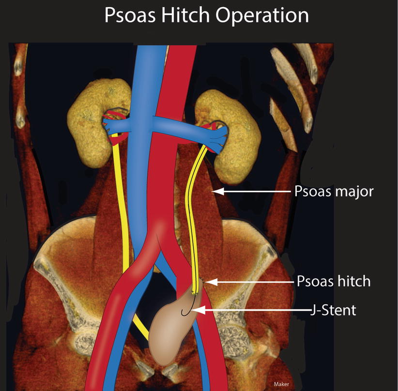 Urinary System | SpringerLink