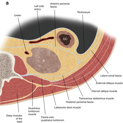 The Extraperitoneal Spaces | SpringerLink