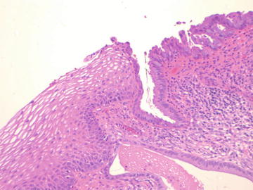 Normal Histology and Cytology of the Endocervix and Endometrium ...