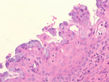 Normal Histology and Cytology of the Endocervix and Endometrium ...