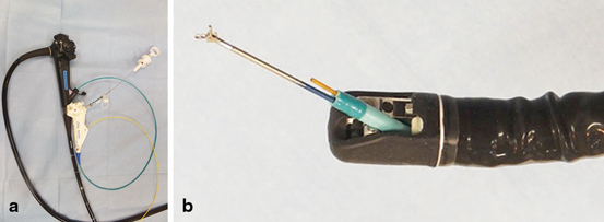 Cholangioscopy | SpringerLink