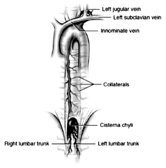 Chyle Leak After Esophageal Surgery | SpringerLink