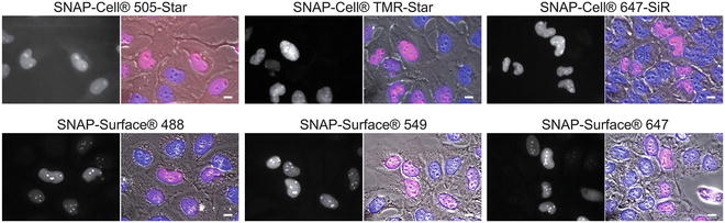 Fluorescent Labeling of SNAP-Tagged Proteins in Cells | SpringerLink