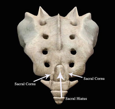 Sacral Injections | SpringerLink