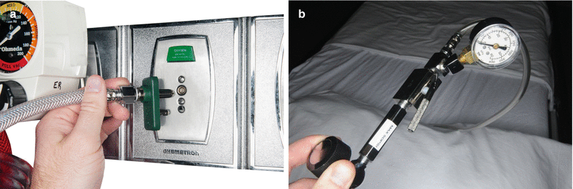 Percutaneous Transtracheal Jet Ventilation | SpringerLink
