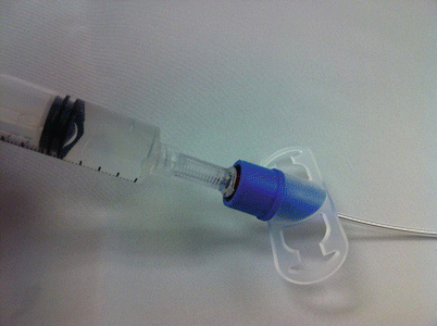 Percutaneous Transtracheal Jet Ventilation | SpringerLink