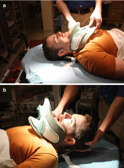 Cervical Collar Placement | SpringerLink