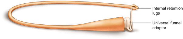 Gastrostomy Tube Placement | SpringerLink