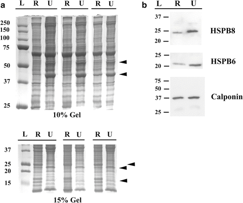 Solubilization of Proteins: The Importance of Lysis Buffer Choice ...