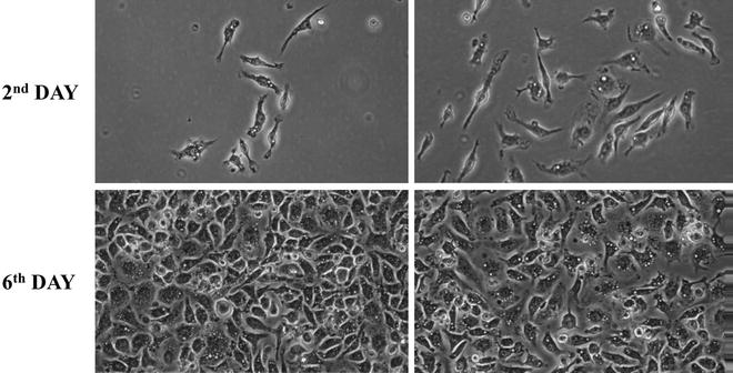 In Vitro Macrophage Phagocytosis Assay | SpringerLink