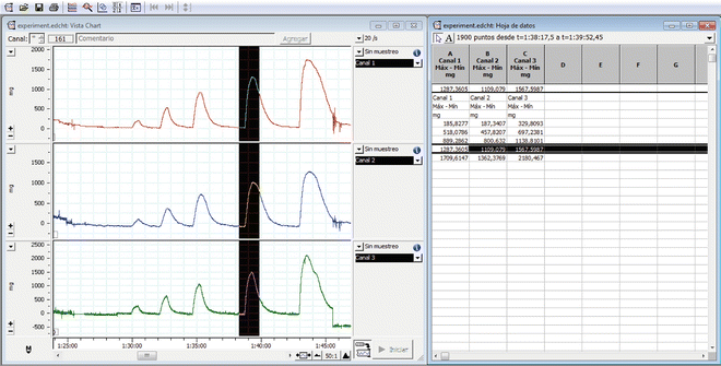 Wire Myography to Study Vascular Tone and Vascular Structure of ...