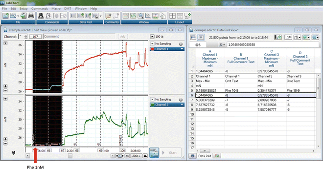 Wire Myography to Study Vascular Tone and Vascular Structure of ...