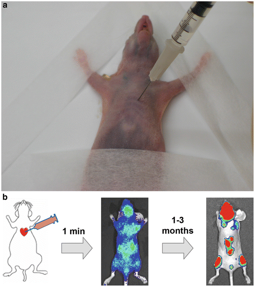 Imaging TGFβ Signaling in Mouse Models of Cancer Metastasis | SpringerLink