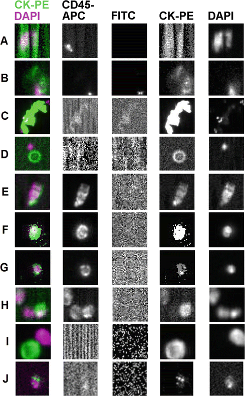Detection and Characterization of Circulating Tumor Cells by the ...
