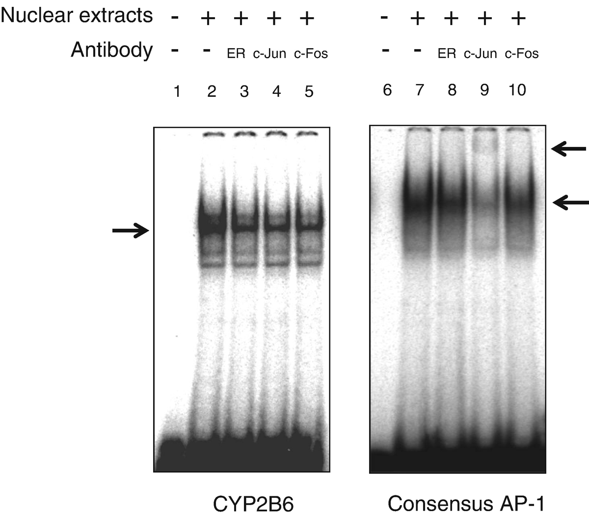 Electrophoretic Mobility Shift Assay (EMSA) and Supershift Assay of ...