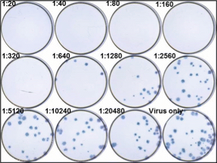 ELISA and Neutralization Methods to Measure Anti-West Nile Virus ...