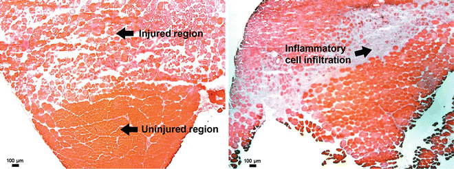 Freeze Injury of the Tibialis Anterior Muscle | SpringerLink