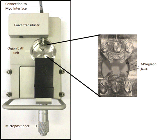 Assessment of Basilar Artery Reactivity in Stroke and Subarachnoid ...