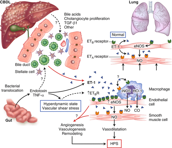 Portopulmonary Hypertension and Hepatopulmonary Syndrome | SpringerLink