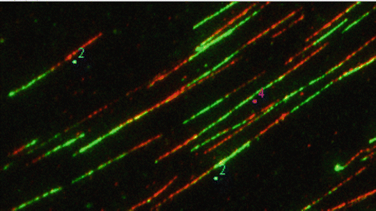DNA Fiber Spreading Assay to Test HDACi Effects on DNA and Its ...