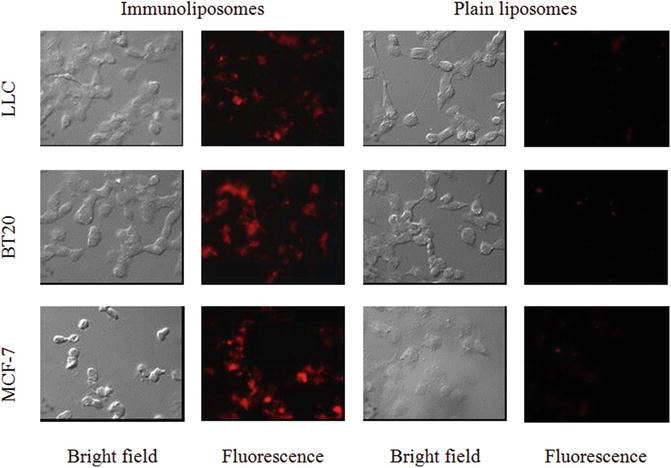 Gadolinium-Loaded Polychelating Polymer-Containing Tumor-Targeted ...