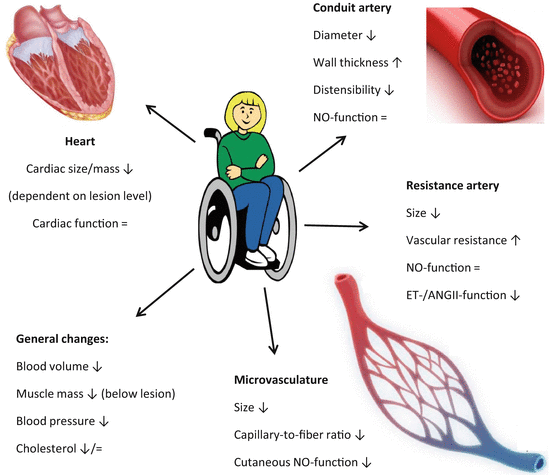 Cardiovascular Responses to Exercise in Spinal Cord Injury | SpringerLink