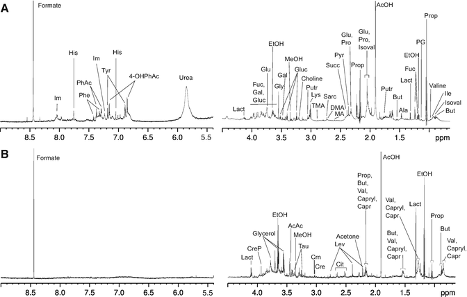 NMR-Based Metabolomics of Oral Biofluids | SpringerLink