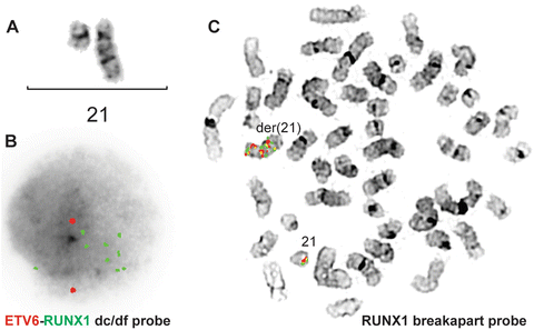 Recurrent Cytogenetic Abnormalities in Acute Lymphoblastic Leukemia ...