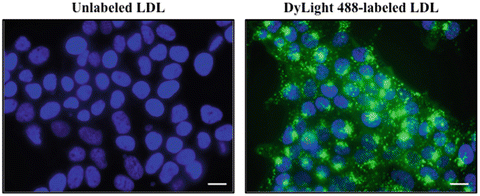 Assaying Low-Density-Lipoprotein (LDL) Uptake into Cells | SpringerLink