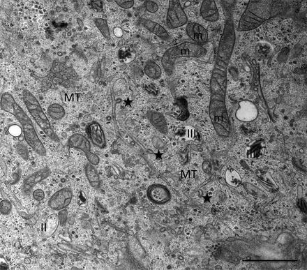 Analyzing Lysosome-Related Organelles by Electron Microscopy | SpringerLink