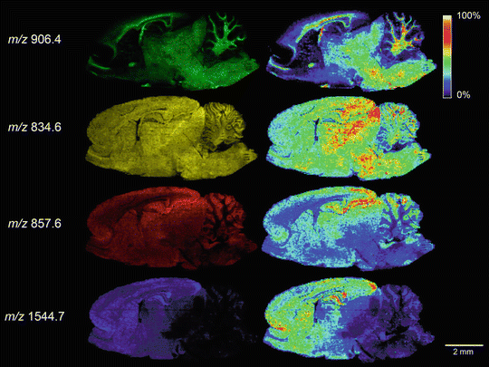 MALDI-Imaging Mass Spectrometry of Brain Lipids | SpringerLink