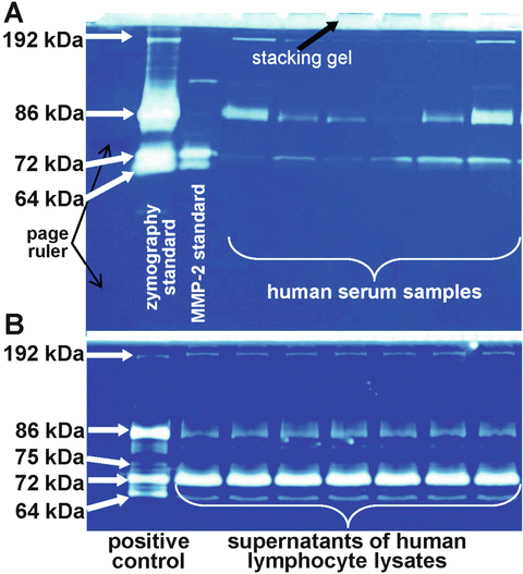 MMP Activity Detection in Zymograms | SpringerLink