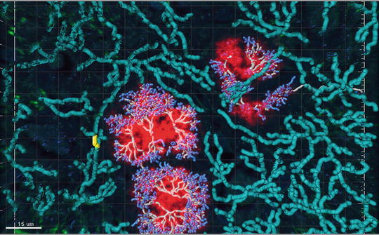 Kuru: Introduction to Prion Diseases | SpringerLink