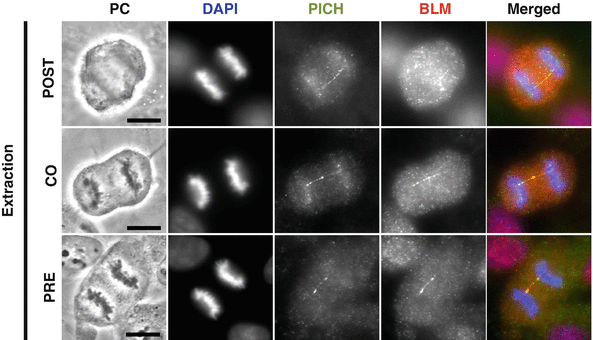 Detection of Ultrafine Anaphase Bridges | SpringerLink