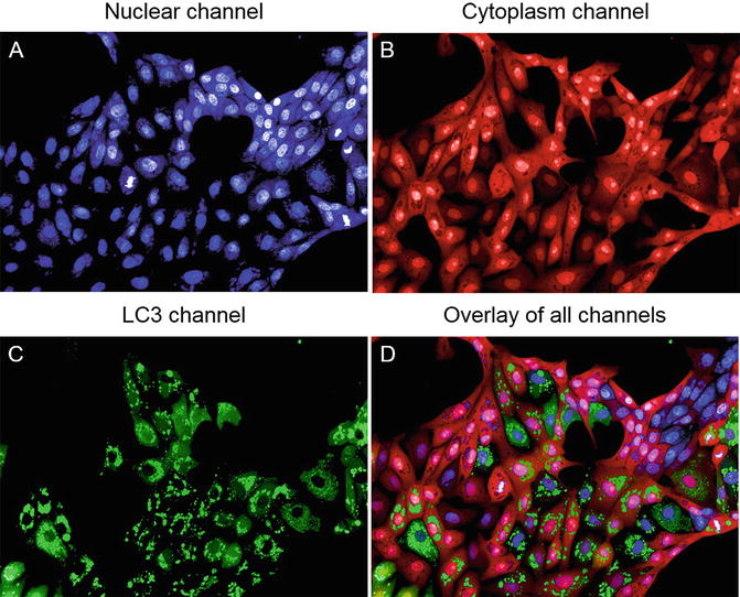 Autophagy Monitoring Assay II: Imaging Autophagy Induction in LLC-PK1 Cells Using GFP-LC3 ...