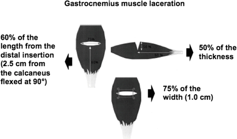 Experimental Model of Skeletal Muscle Laceration in Rats | SpringerLink