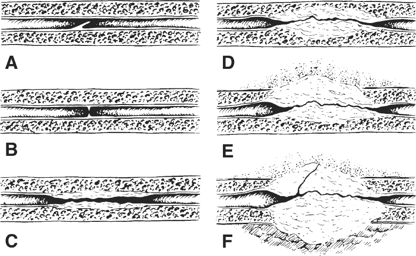 Epidemiology, Etiology, Histology, Classification, and Economic Impact ...