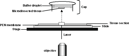 Combining Laser Capture Microdissection and Proteomics Techniques ...