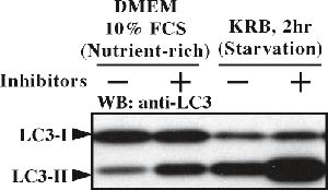LC3 and Autophagy | SpringerLink