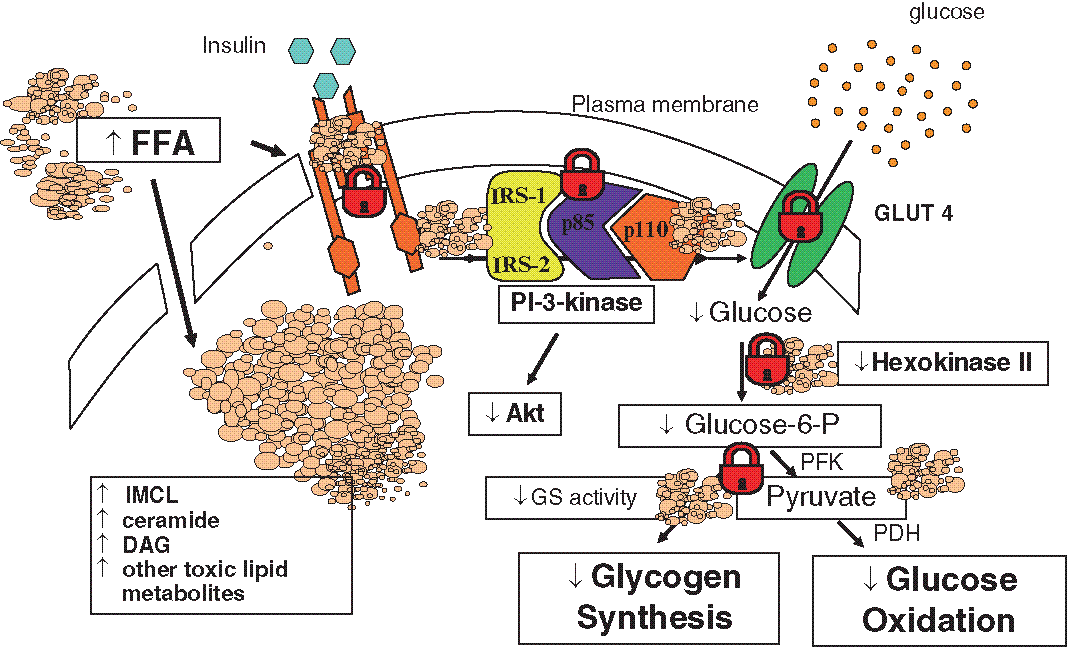 The Epidemic of Type 2 Diabetes Mellitus: Its Links to Obesity, Insulin ...