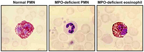 Diagnostic Assays for Myeloperoxidase Deficiency | SpringerLink