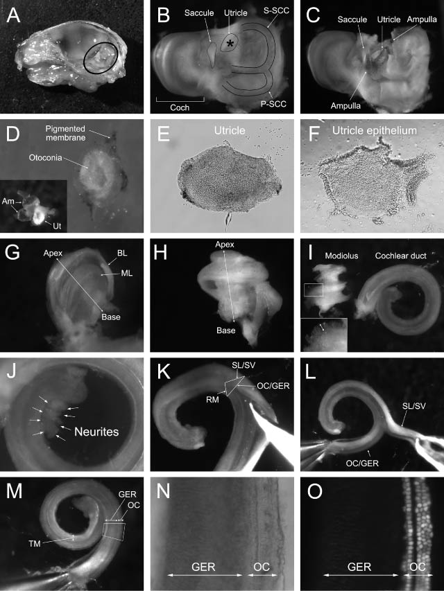 Isolation of Sphere-Forming Stem Cells from the Mouse Inner Ear ...