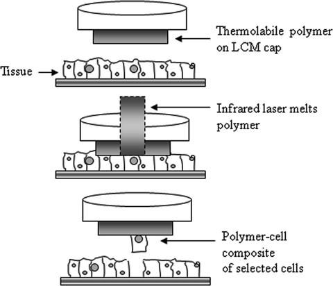 Laser Capture Microdissection: ArcturusXT Infrared Capture and UV ...