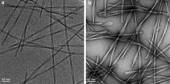 Transmission Electron Microscopy of Amyloid Fibrils | SpringerLink