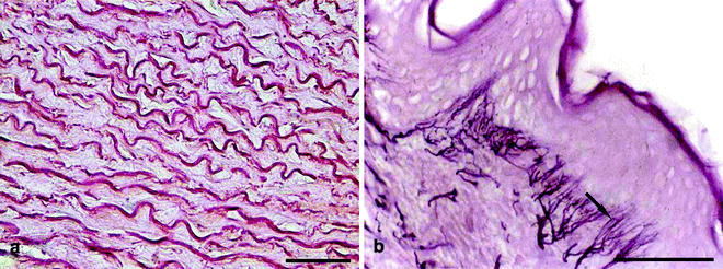 Special Stains for Extracellular Matrix | SpringerLink