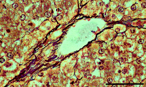 Special Stains for Extracellular Matrix | SpringerLink