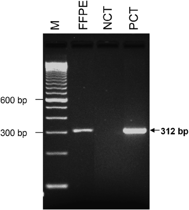 An Optimized RNA Extraction Method from Archival Formalin-Fixed Paraffin-Embedded Tissue ...
