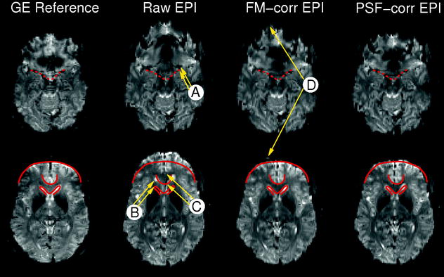 fMRI of Emotion | SpringerLink