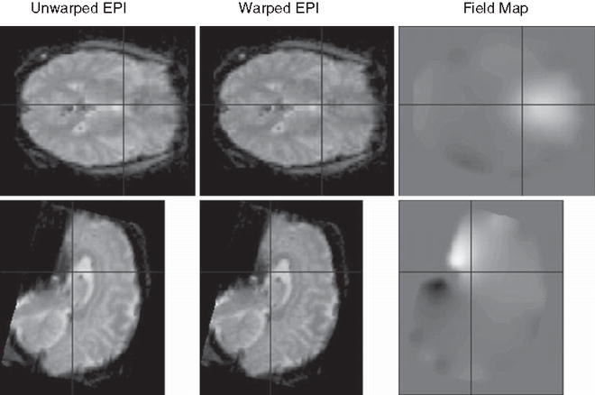 Preparing fMRI Data for Statistical Analysis | SpringerLink